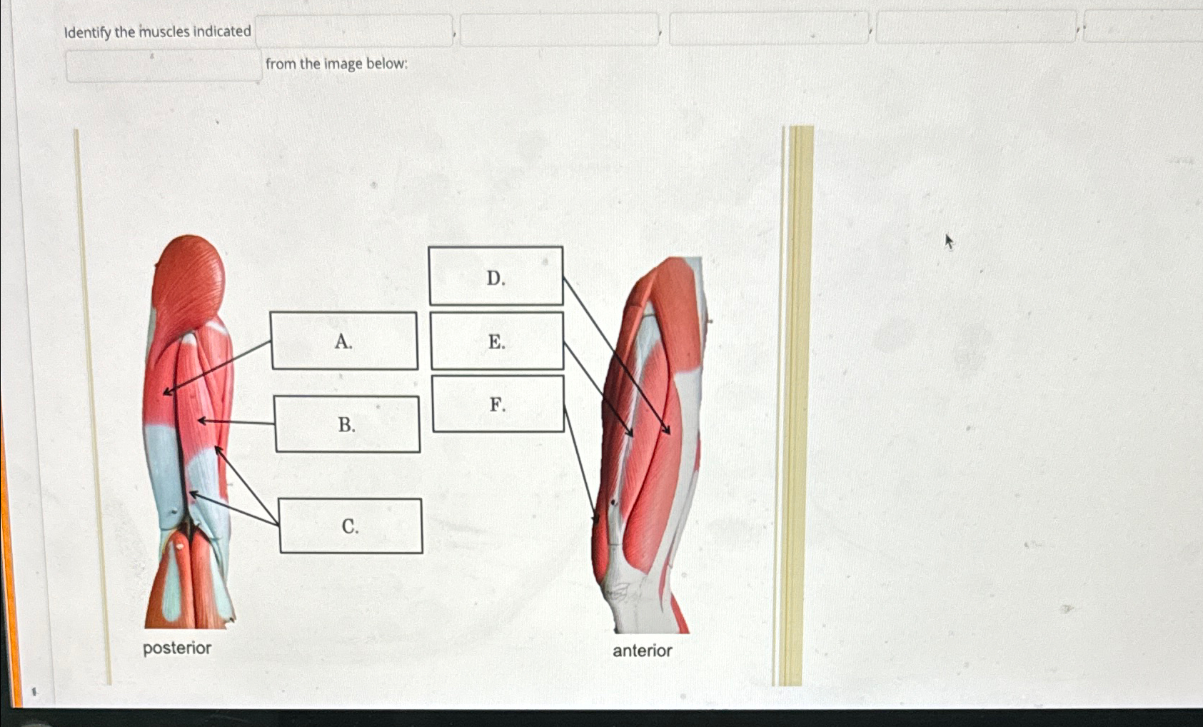 Solved Identify the muscles indicatedfrom the image below: | Chegg.com