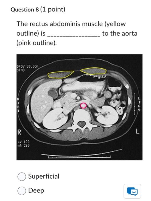 Solved The rectus abdominis muscle (yellow outline) is to | Chegg.com