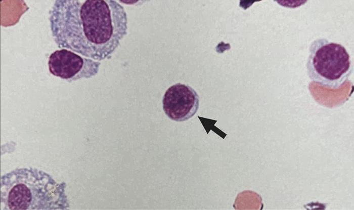 Solved identify from microscopy of a body fluid | Chegg.com