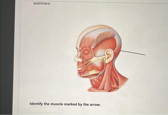 Solved Identify the muscle marked by the arrow. | Chegg.com
