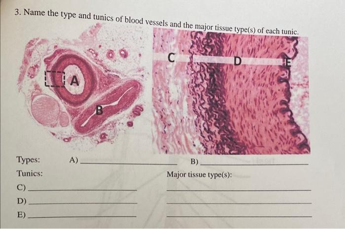 Solved Name the type and tunics of blood vessels and the | Chegg.com