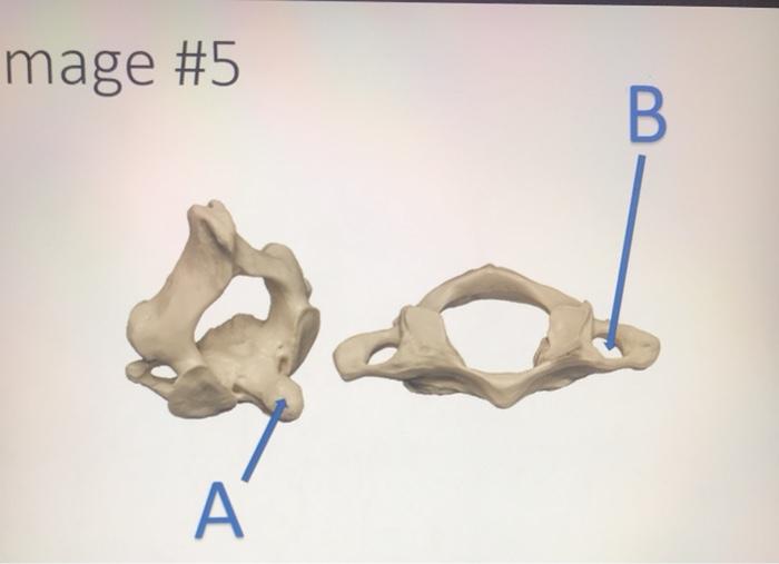 Solved # IDENTIFY R/L& Bone VIEW (Anterior/Posterior) | Chegg.com