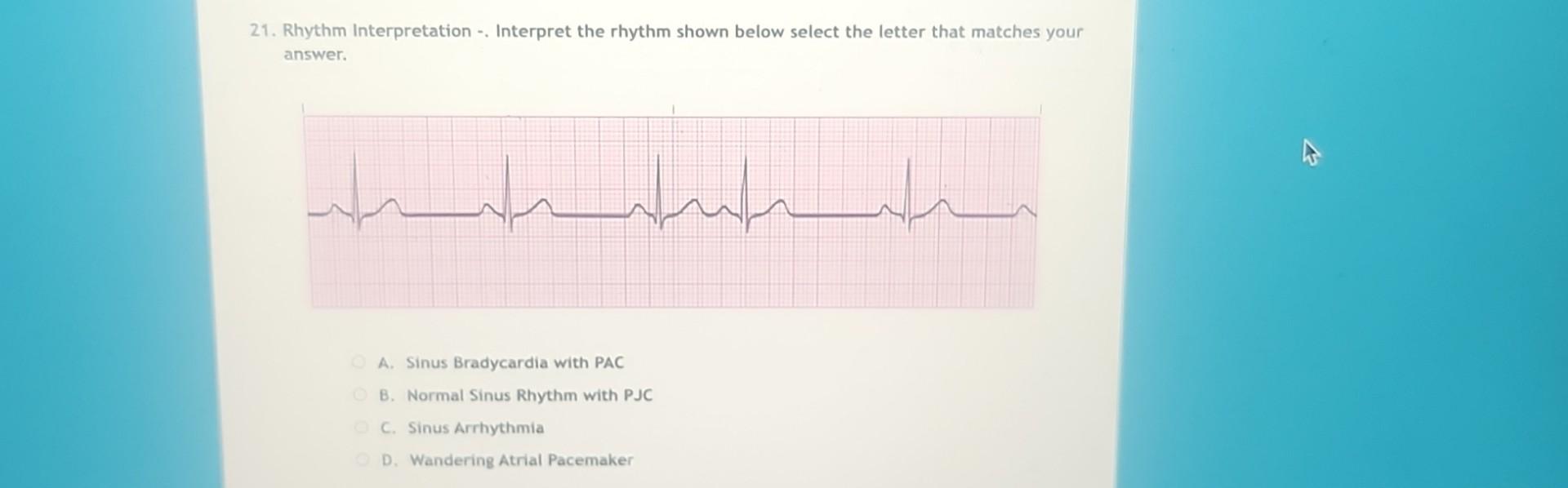Solved 21. Rhythm Interpretation -. Interpret the rhythm | Chegg.com