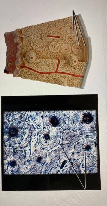 Solved 獎 Which structure is highlighted and indicated by | Chegg.com