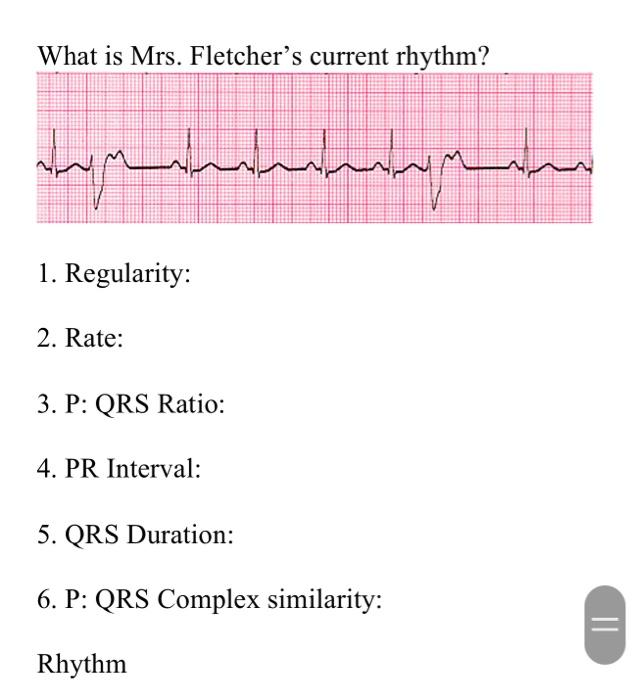 Solved What is Mrs. Fletcher's current rhythm? 1. | Chegg.com