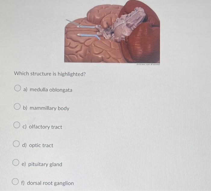 Solved Which structure is highlighted? a) medulla oblongata | Chegg.com