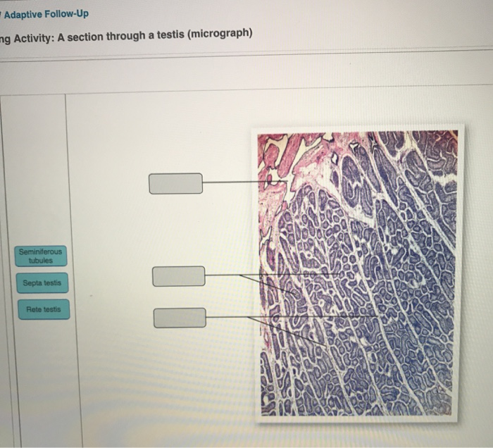 Solved Adaptive Follow-Up ng Activity: A section through a | Chegg.com