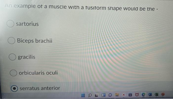 Solved An example of a muscle with a fusiform shape would be | Chegg.com