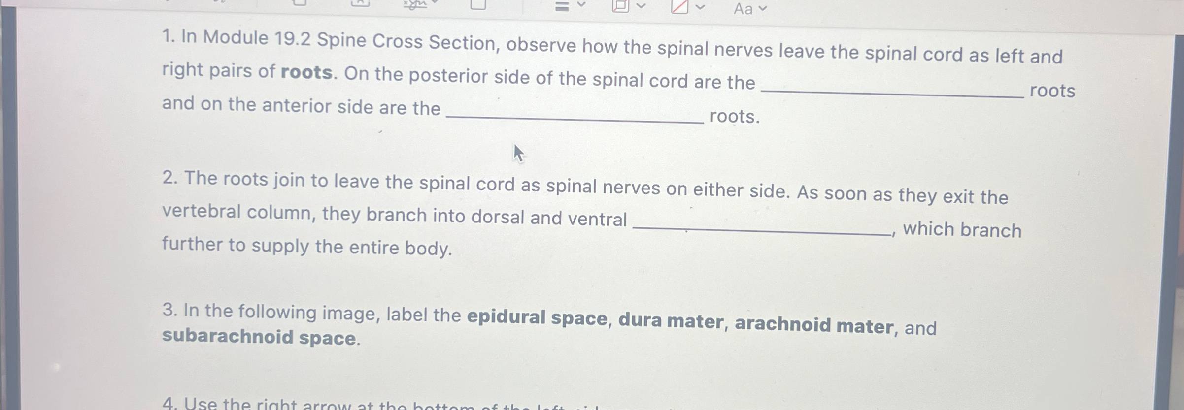 Solved In Module 19.2 ﻿Spine Cross Section, observe how the | Chegg.com