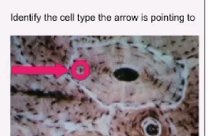 Solved Identify the cell type the arrow is pointing to | Chegg.com