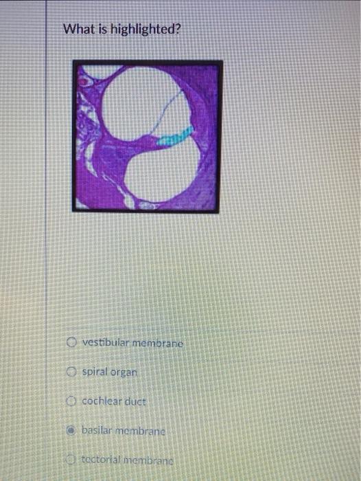 Solved What is highlighted? O vestibular membrane spiral | Chegg.com