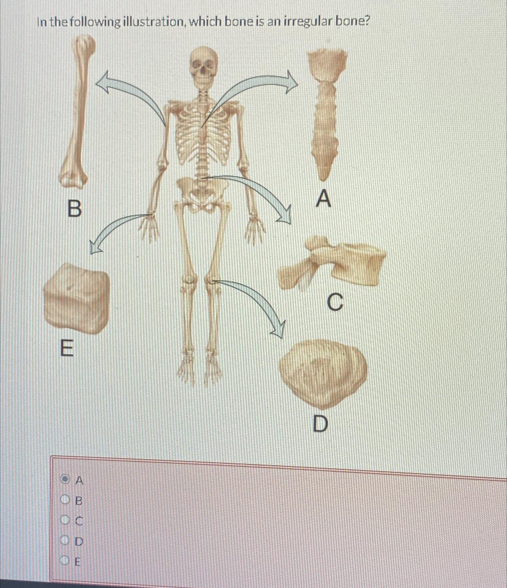 Solved In the following illustration, which bone is an | Chegg.com