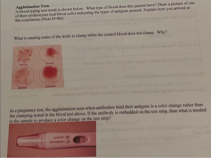 Solved Agglutination Tests A blood typing test result is | Chegg.com