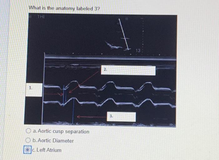 Solved What is the anatomy labeled 3? THI a. Aortic cusp | Chegg.com