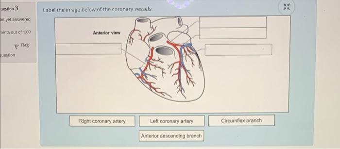 Label the image below of the coronary vessels. oints | Chegg.com