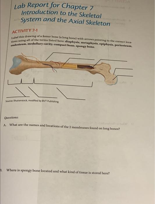 Solved Lab Report for Chapter 7 Introduction to the Skeletal | Chegg.com