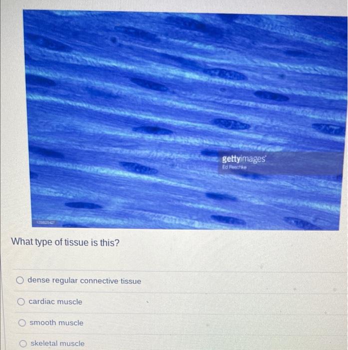 Dense Regular Connective Tissue Vs Smooth Muscle