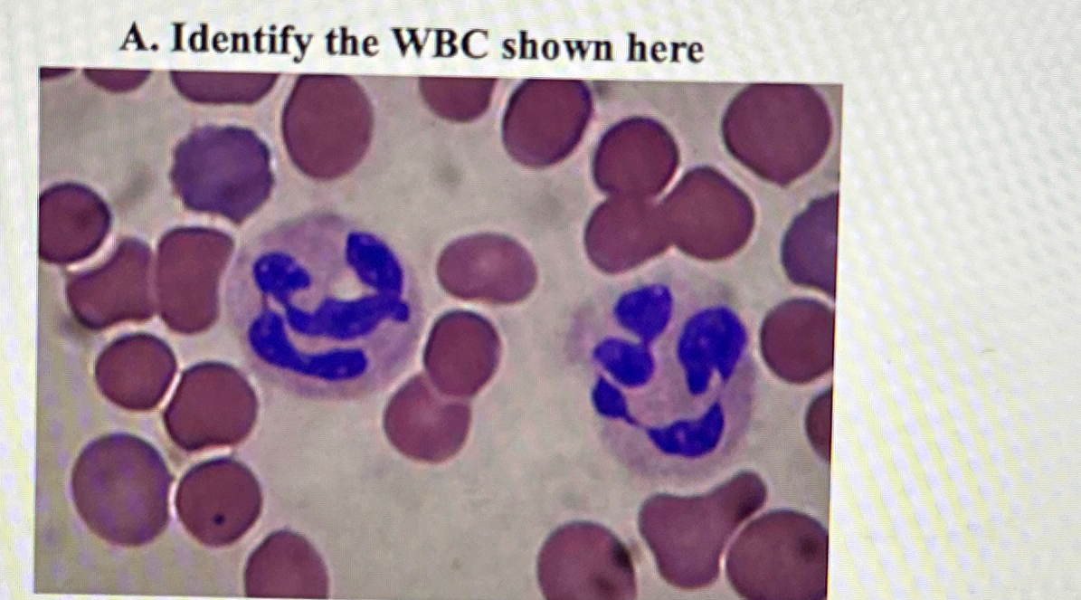 Solved A. ﻿Identify the WBC shown here | Chegg.com