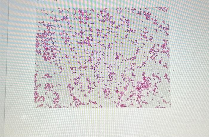 Solved lab staining. what can be determined from this slide? | Chegg.com