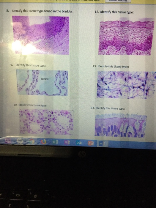 Solved 8. Identify this tissue type found in the bladder: | Chegg.com