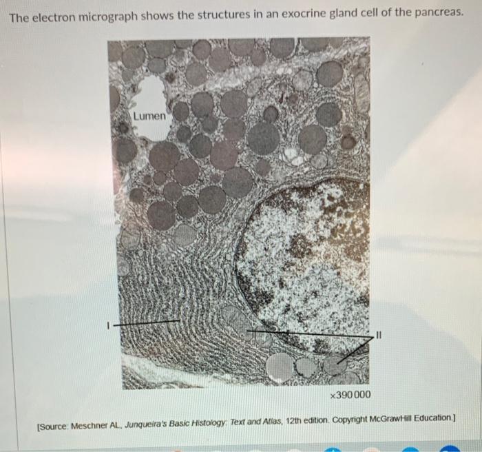 Solved The electron micrograph shows the structures in an | Chegg.com