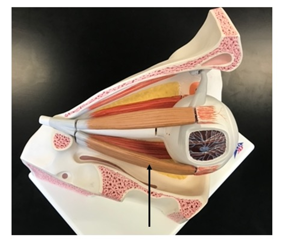 Solved Name the muscle marked by the black arrow.| | Chegg.com