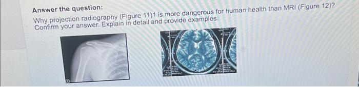 Solved Answer the question: Why projection radiography | Chegg.com