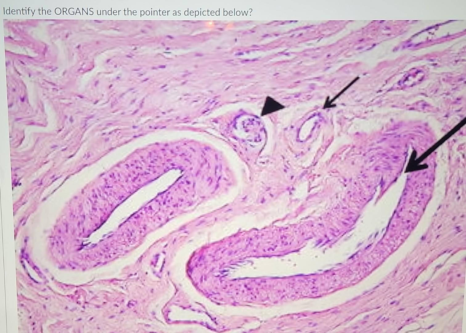 Solved Identify the ORGANS under the pointer as depicted | Chegg.com