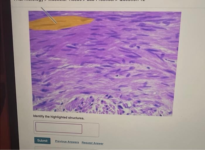 Solved Idenury the highlighted fiber type. Identify the | Chegg.com