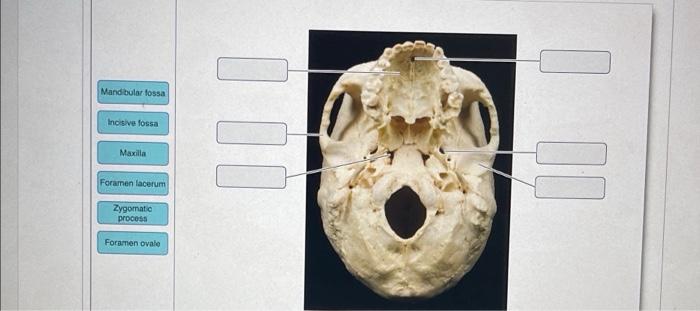 Solved Mandibular fossa Incisive fossa Maxilla Foramen | Chegg.com