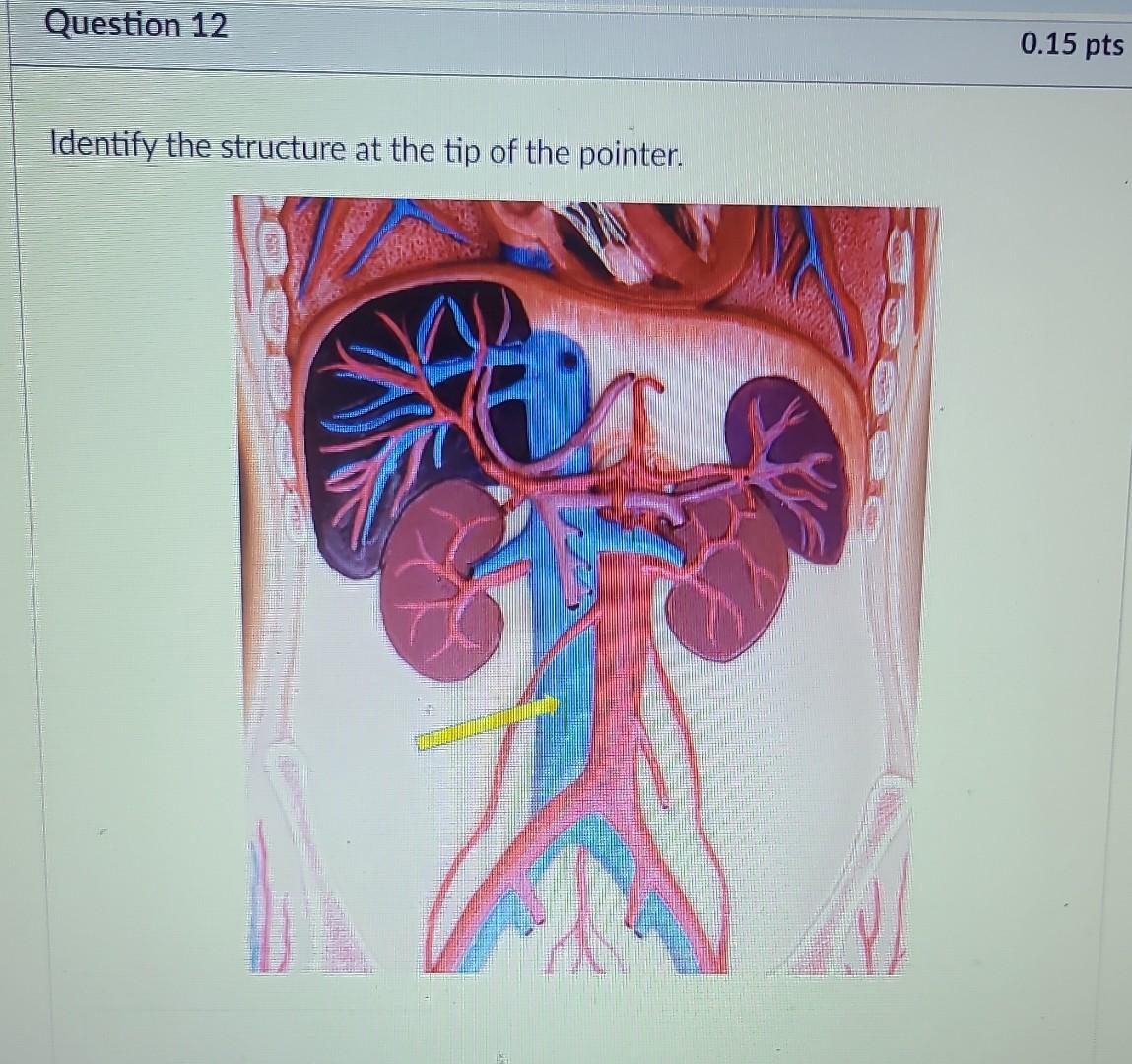 Solved Identify the structure at the tip of the pointer. | Chegg.com