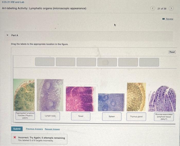 Solved Art-labeling Activity: Lymphatic organs (microscopic | Chegg.com