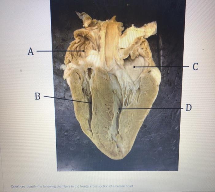 Solved A- ЕС B- - D Question: Identify the following | Chegg.com