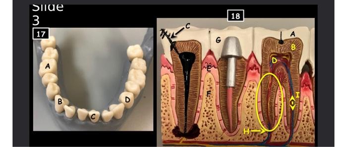 Solved 17) identify the mandibular teeth18) identify the | Chegg.com
