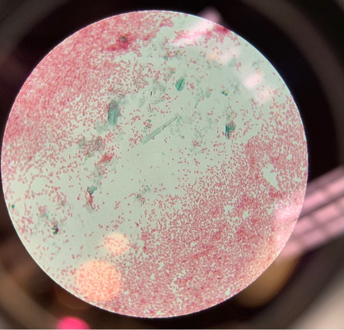Solved Endospore stain positive or negativeEndospore stain | Chegg.com