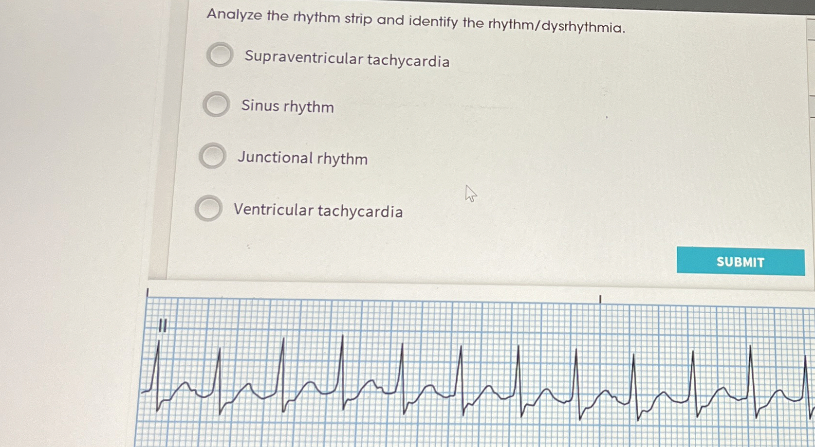 Solved Analyze the rhythm strip and identify the | Chegg.com