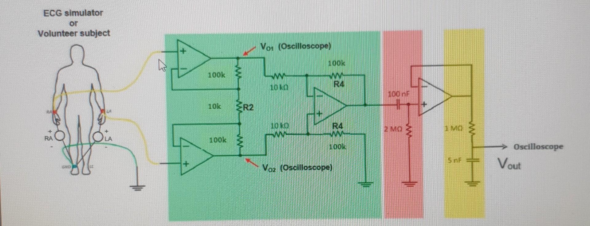 Solved a Analytical Practice Study In the ECG amplifier | Chegg.com