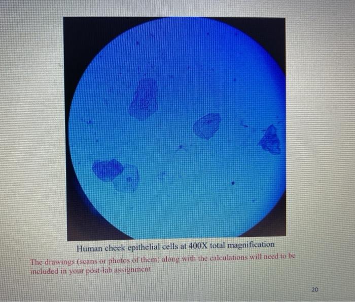 Solved Elodea leaf at 400X total magnification A Human | Chegg.com