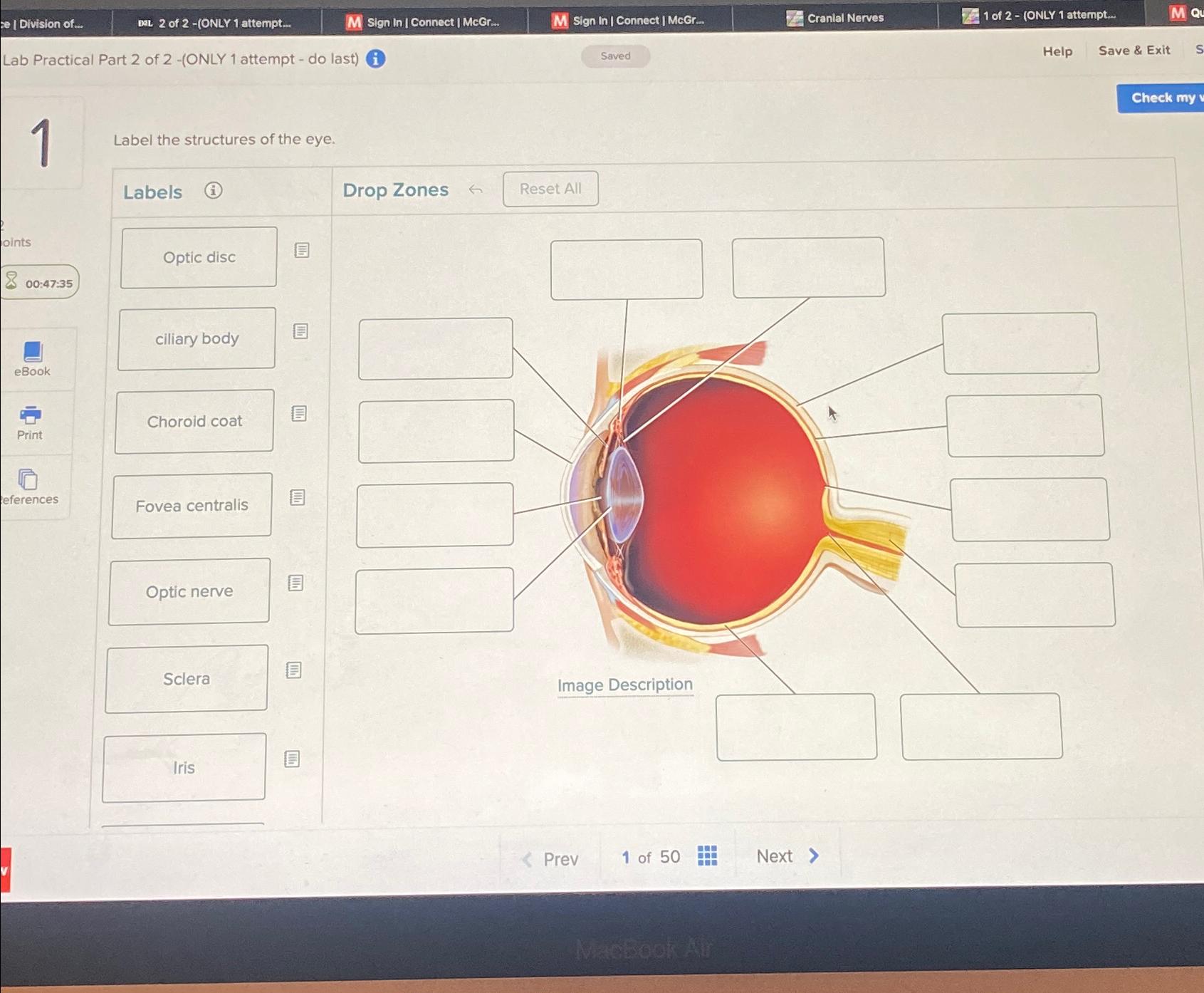 Solved Lab Practical Part 2 ﻿of 2 -(ONLY 1 ﻿attempt - ﻿do | Chegg.com