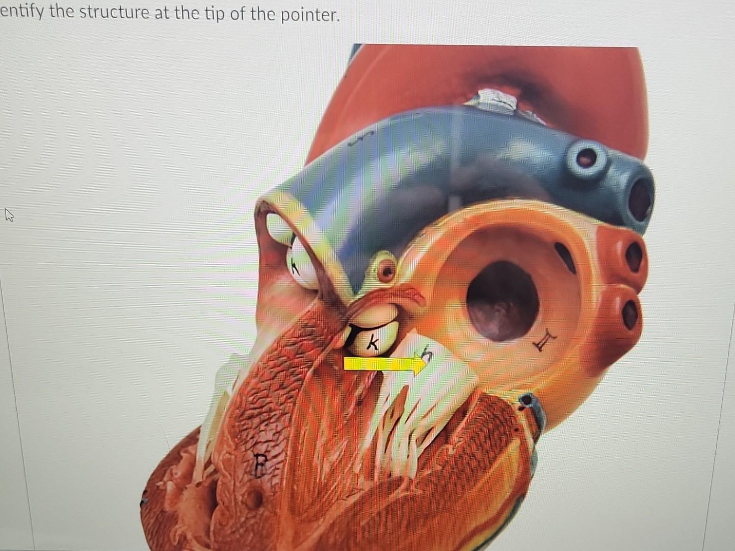 Solved dentify the structure at the tip of the | Chegg.com