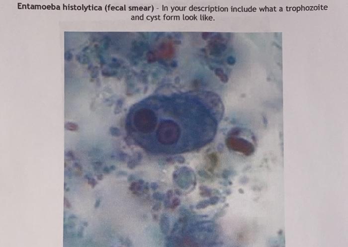 Solved Entamoeba histolytica (fecal smear) - In your | Chegg.com