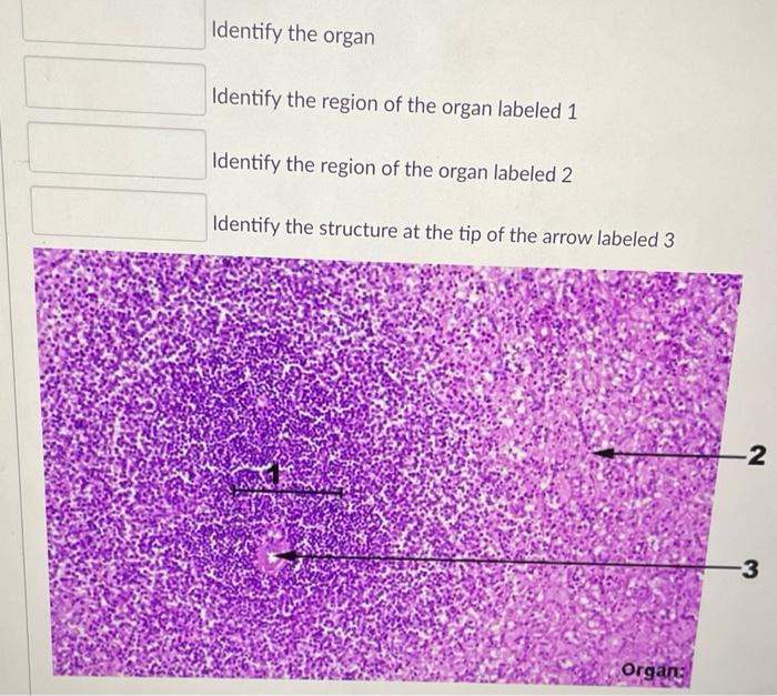 Identify the organ. Identify the region of the organ | Chegg.com