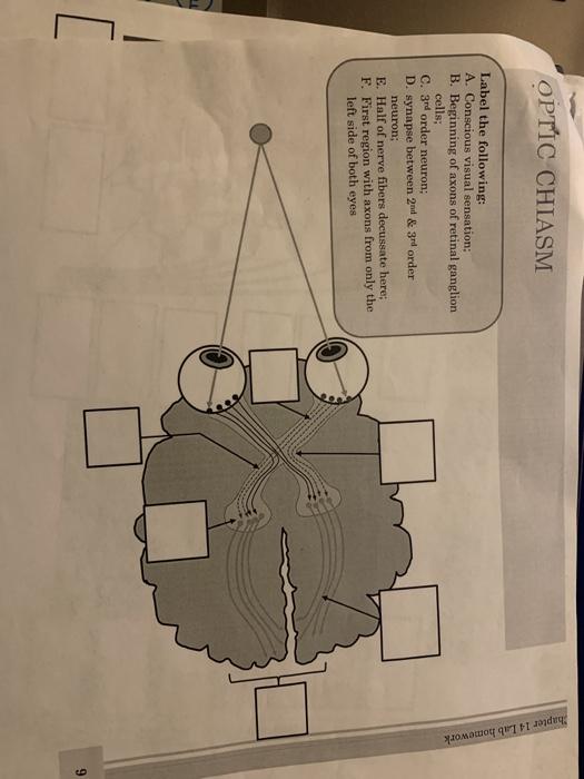 Solved OPTIC CHIASM Chapter 14 Lab homework Label the | Chegg.com