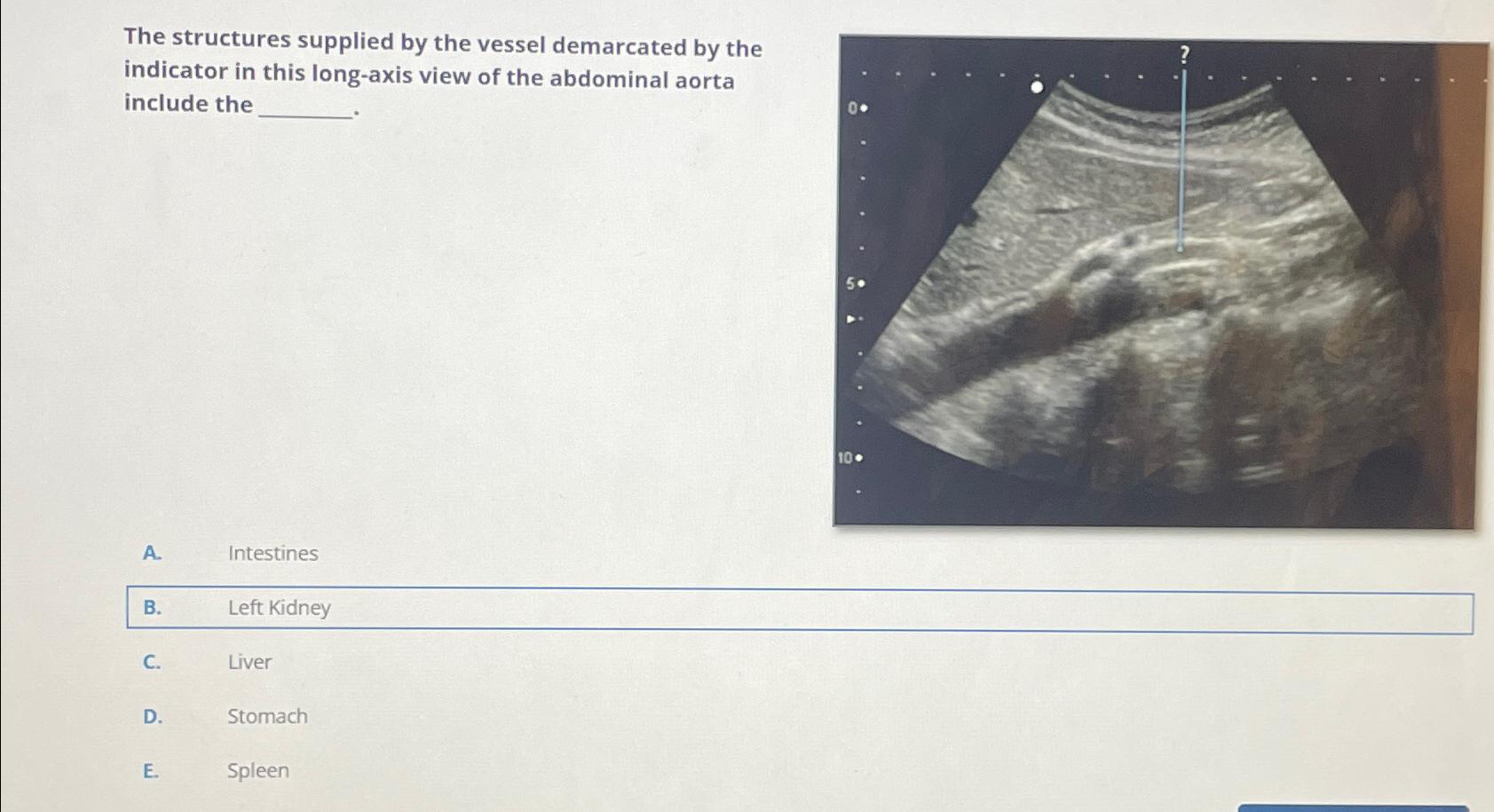 Solved The structures supplied by the vessel demarcated by | Chegg.com