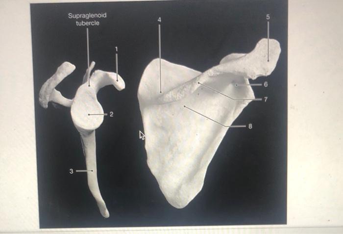 Solved Supraglenoid tubercle 3 Identify the structure | Chegg.com