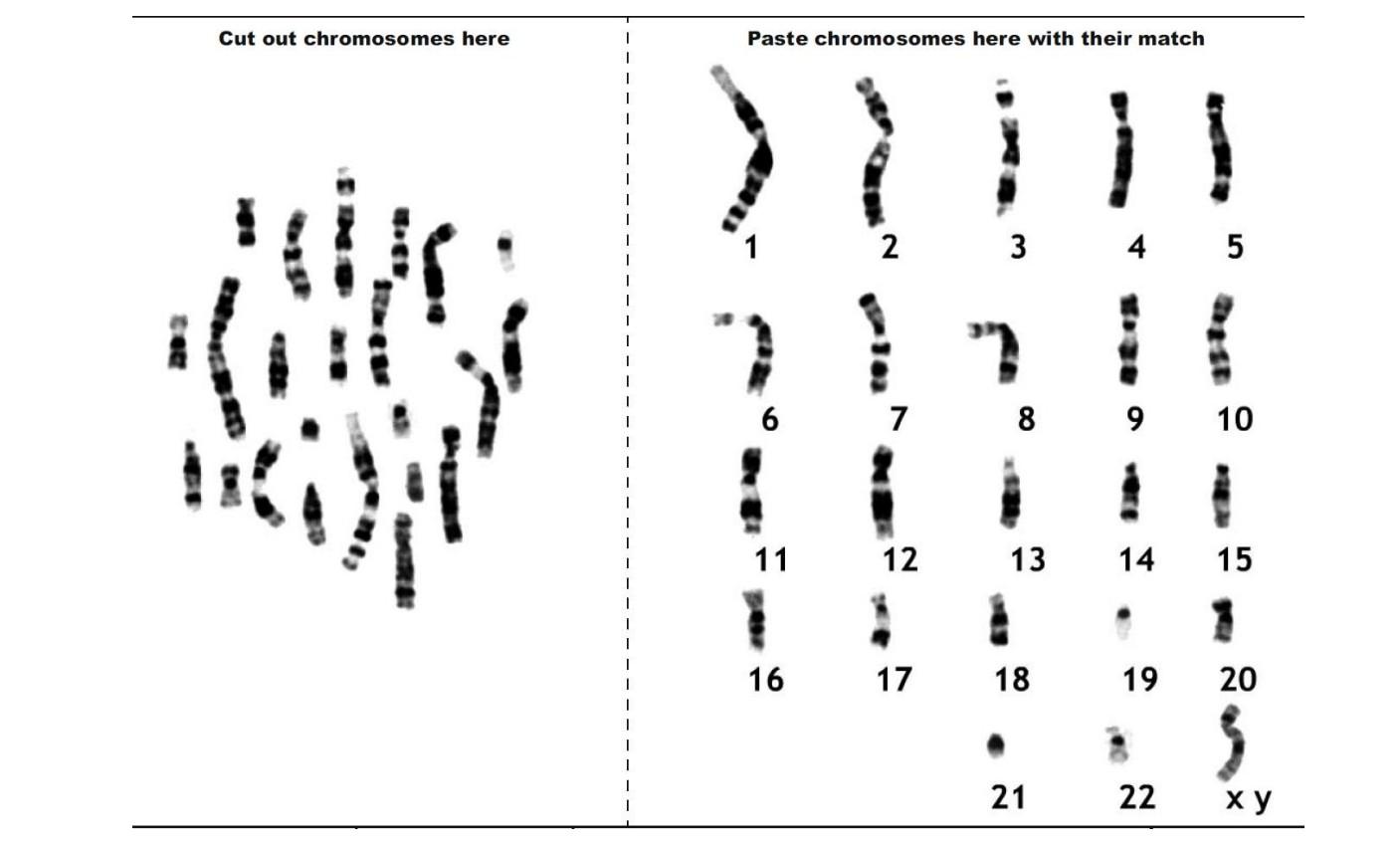 Set A 5. 8 Ai Human Karyotype Form ī 1 3 3 4 5 | Chegg.com
