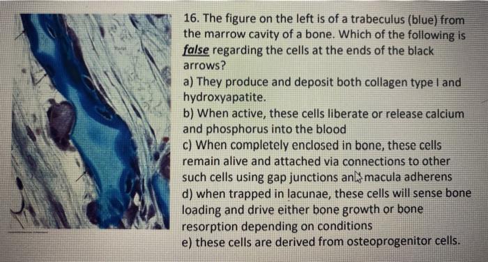Solved 16. The figure on the left is of a trabeculus (blue) | Chegg.com