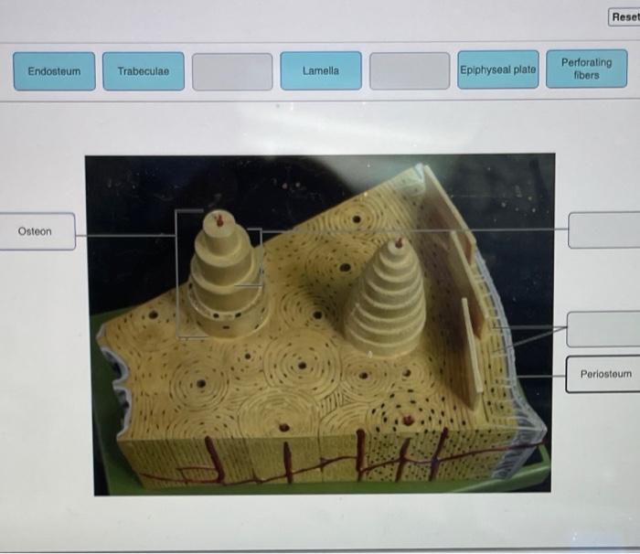 Solved arrangement of a compact bone. using the picture of a | Chegg.com