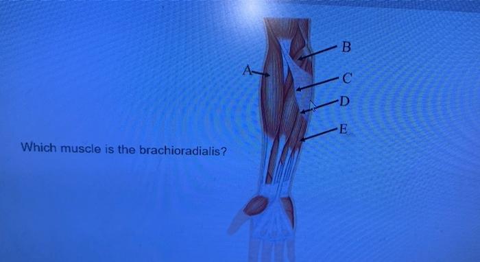Solved 1-ron injured several muscles on his medial humeral | Chegg.com