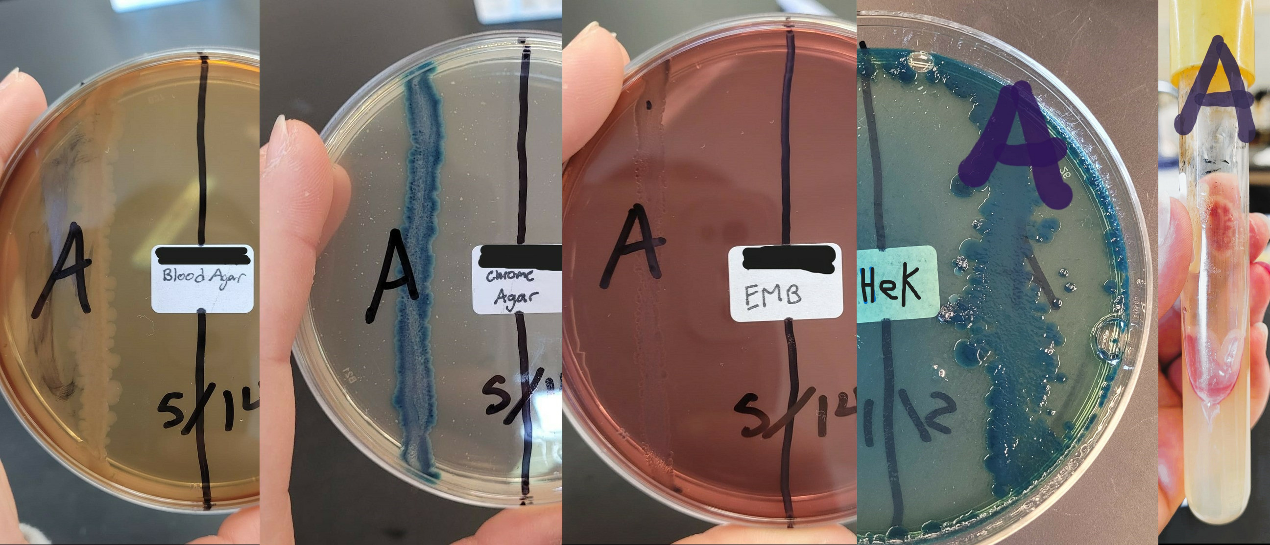 Solved Chromagar had blue colonies, Hektoen had greenish and | Chegg.com
